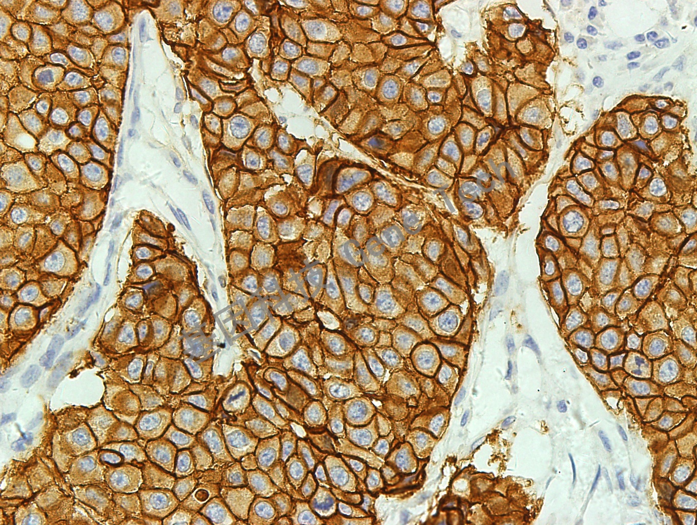 C-erbB-2（Her-2/neu）兔抗人 C-erbB-2