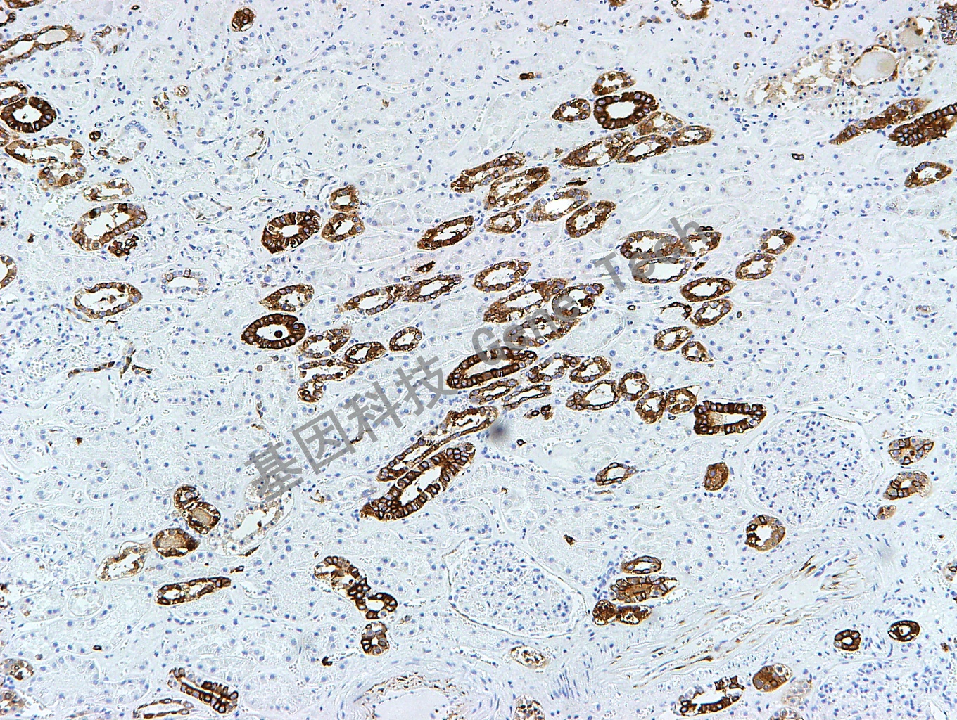 细胞角蛋白7（CK7）抗体 鼠抗人 CK7