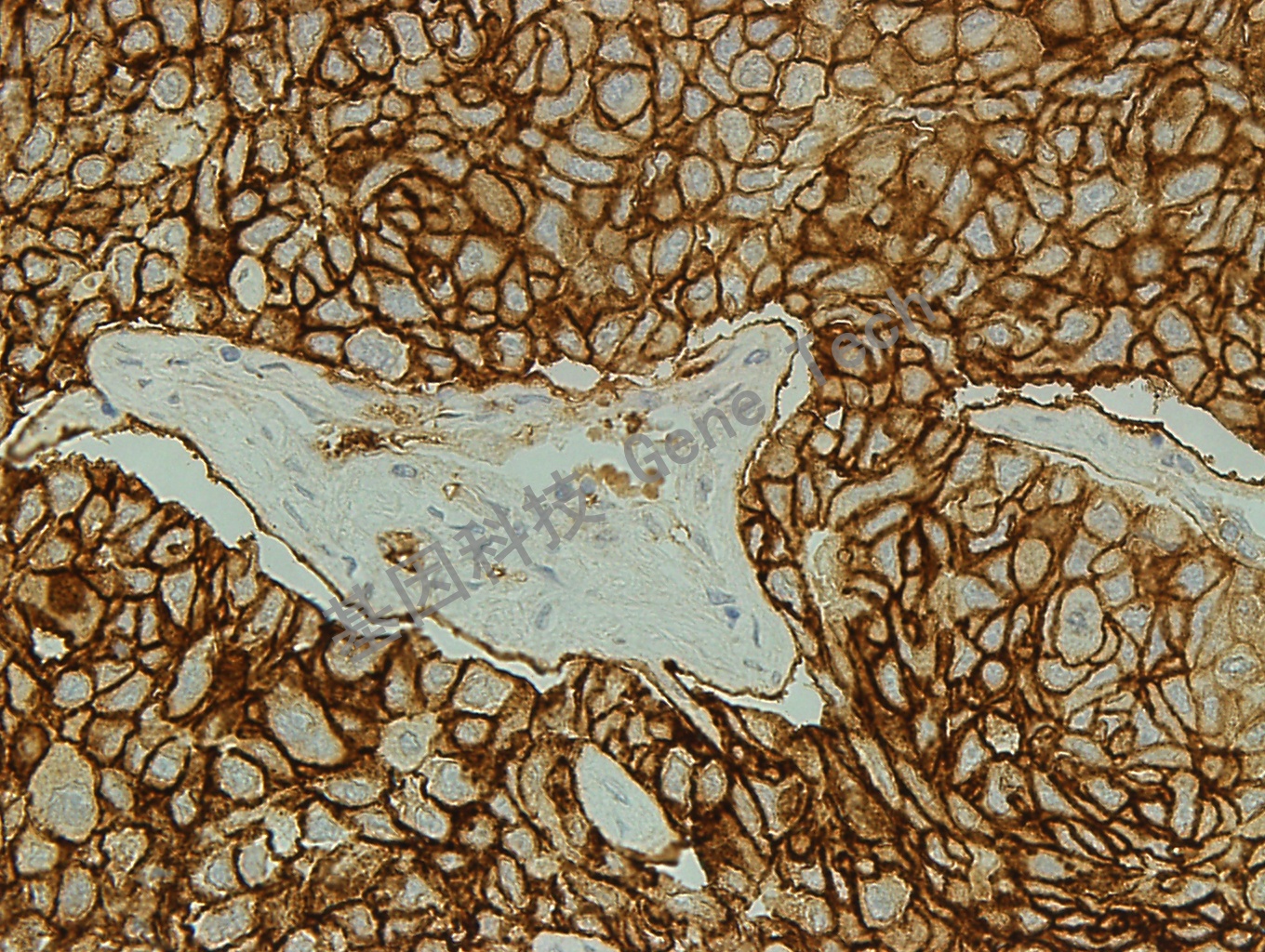 CA IX 碳酸酐酶9 抗体 鼠抗人 CAIX，CA9