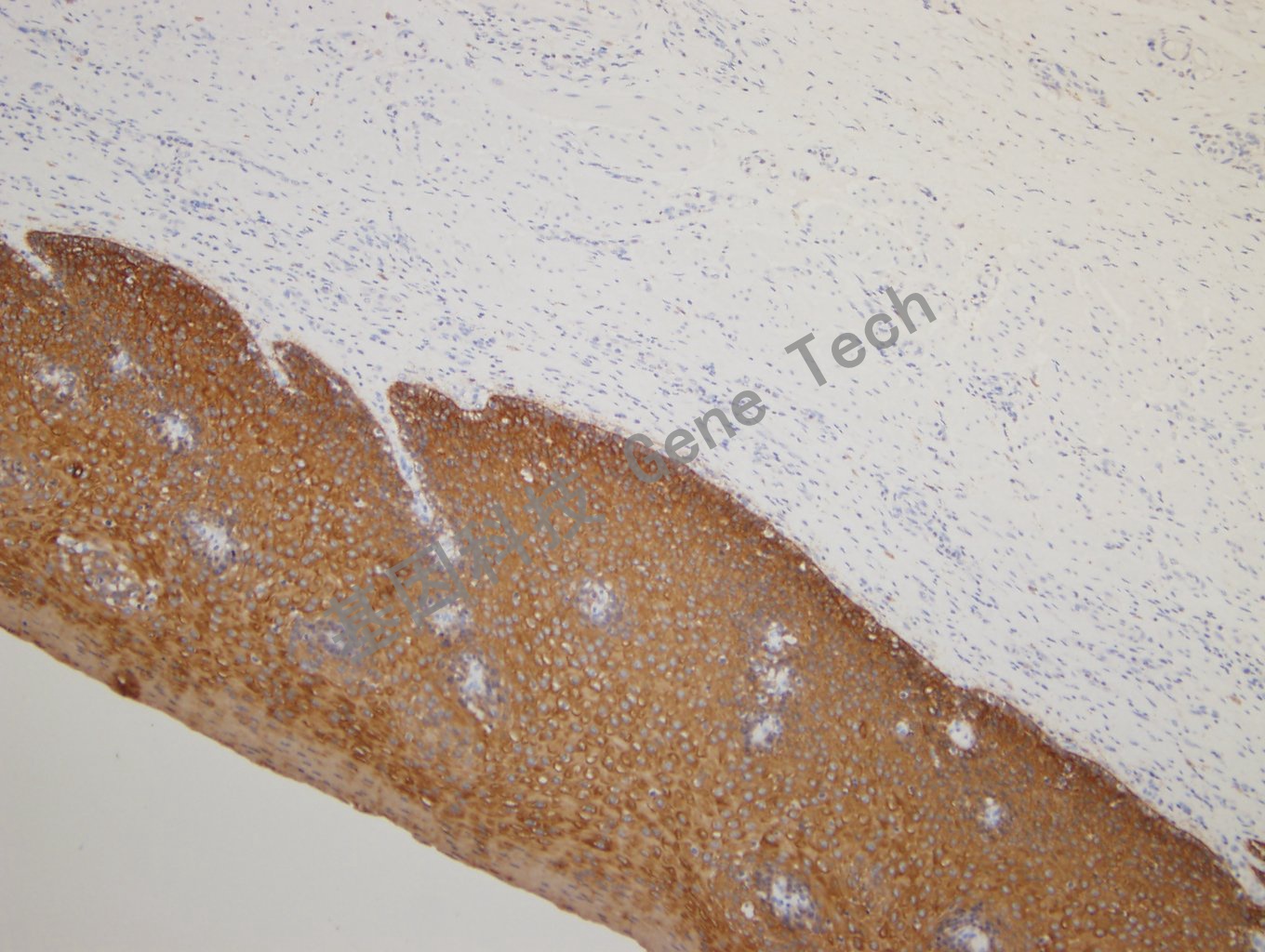 CK，Pan 鼠抗人 细胞角蛋白（广谱）抗体试剂（免疫组织化学）