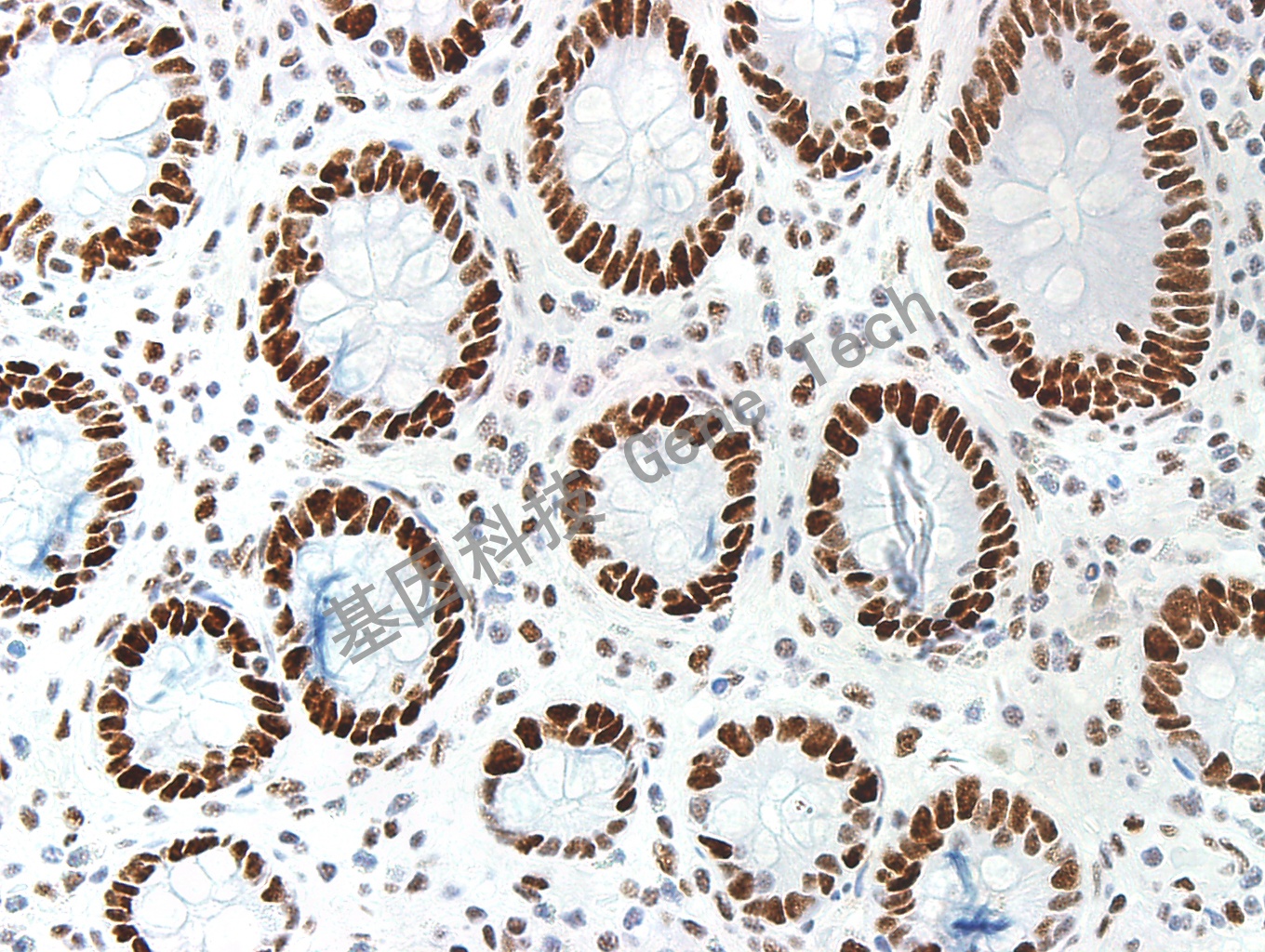 MSH6 兔抗人 MSH6 抗体试剂（免疫组织化学）