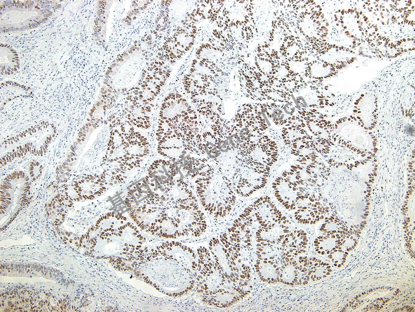 MSH6 兔抗人 MSH6 抗体试剂（免疫组织化学）