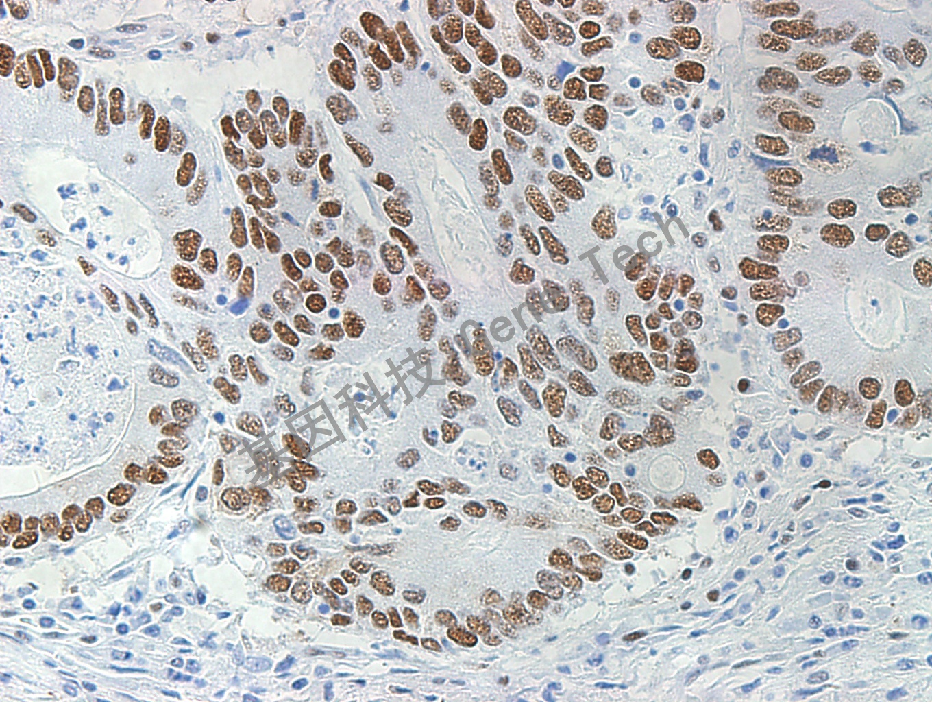 MSH6 兔抗人 MSH6 抗体试剂（免疫组织化学）