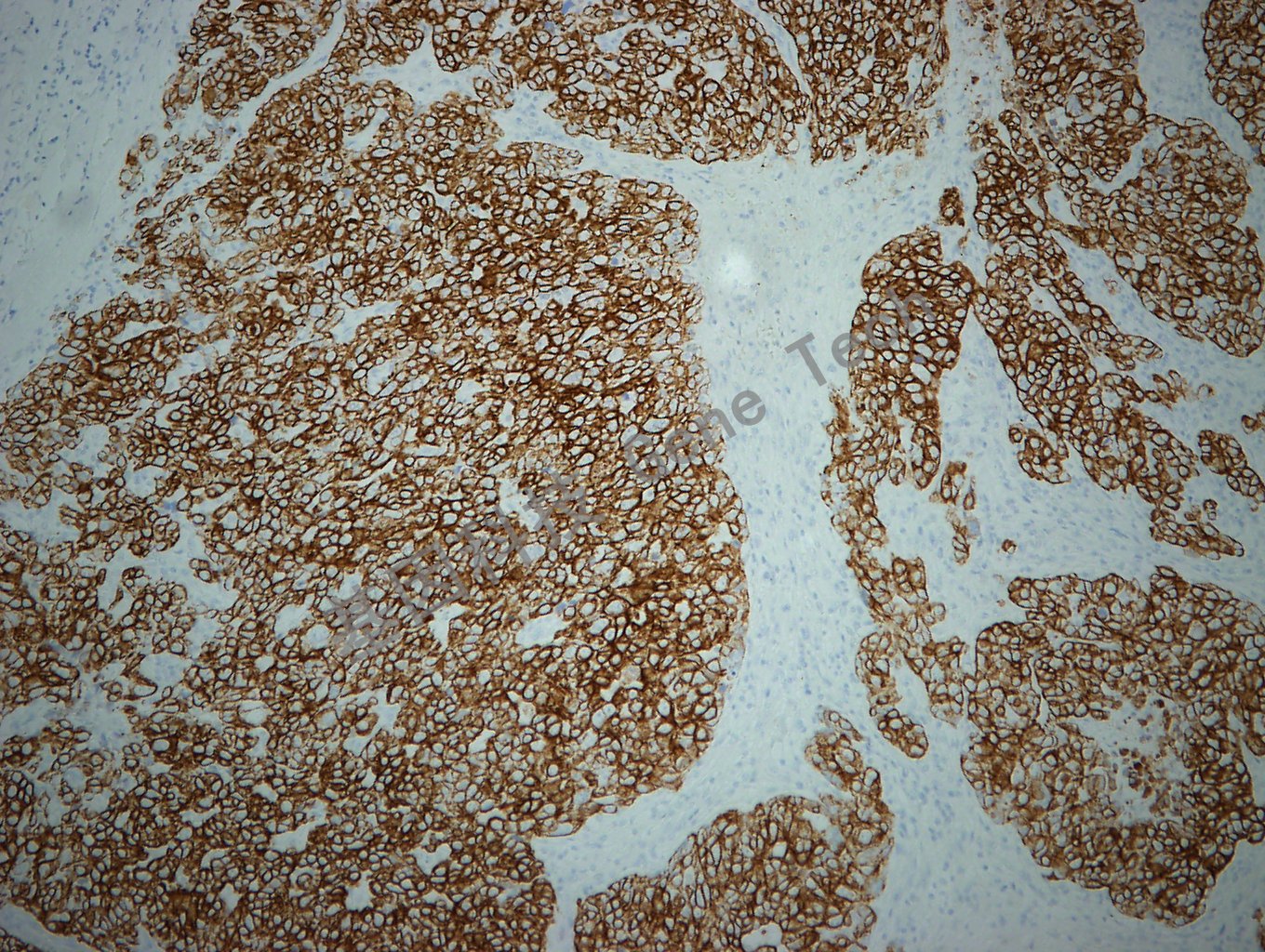 细胞角蛋白7（CK7）抗体 鼠抗人 CK7