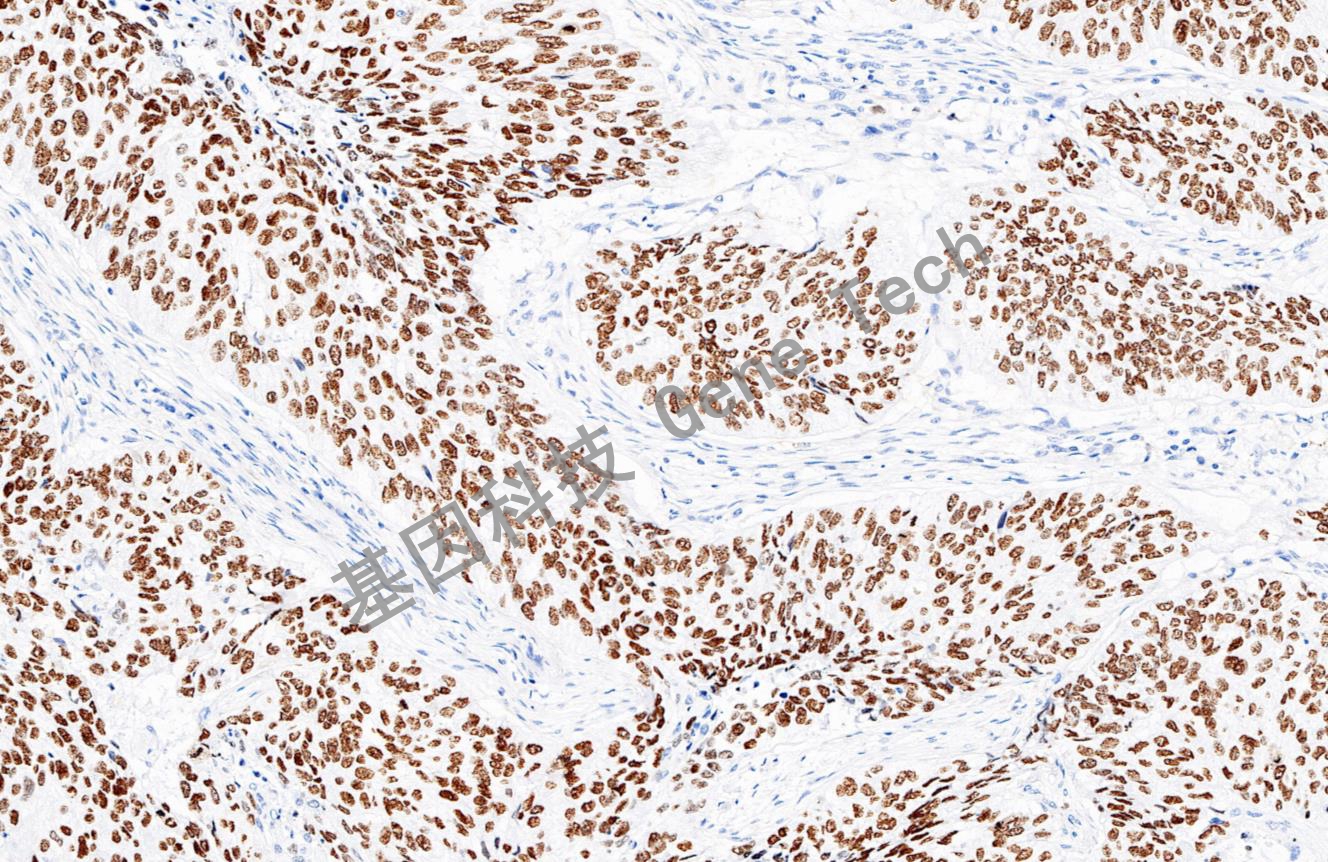 p40 兔抗人 p40 抗体试剂（免疫组织化学）