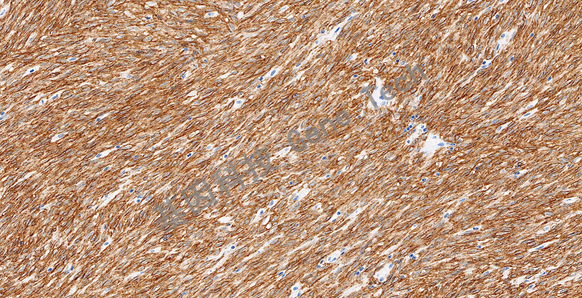 CD117（c-kit）兔抗人 CD117（c-kit）