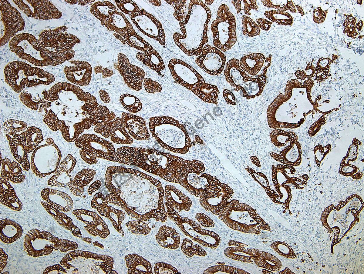 细胞角蛋白 CAM5.2 抗体 鼠抗人 低分子角蛋白 Cam5.2