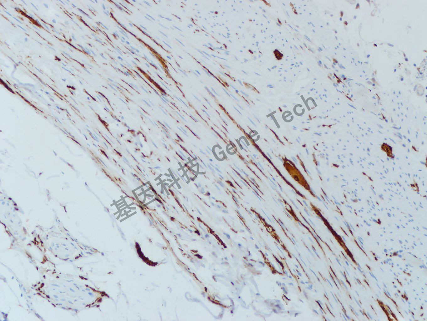 PGP9.5 兔抗人 Protein Gene Product 9.5 抗体试剂（免疫组织化学）
