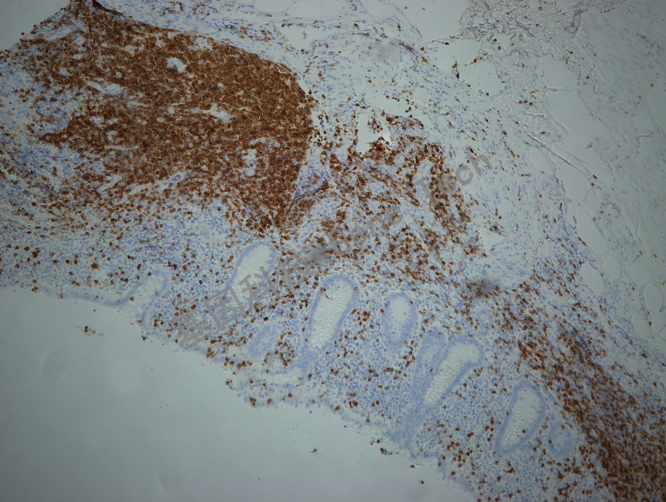 CD3 抗体 鼠抗人 CD3