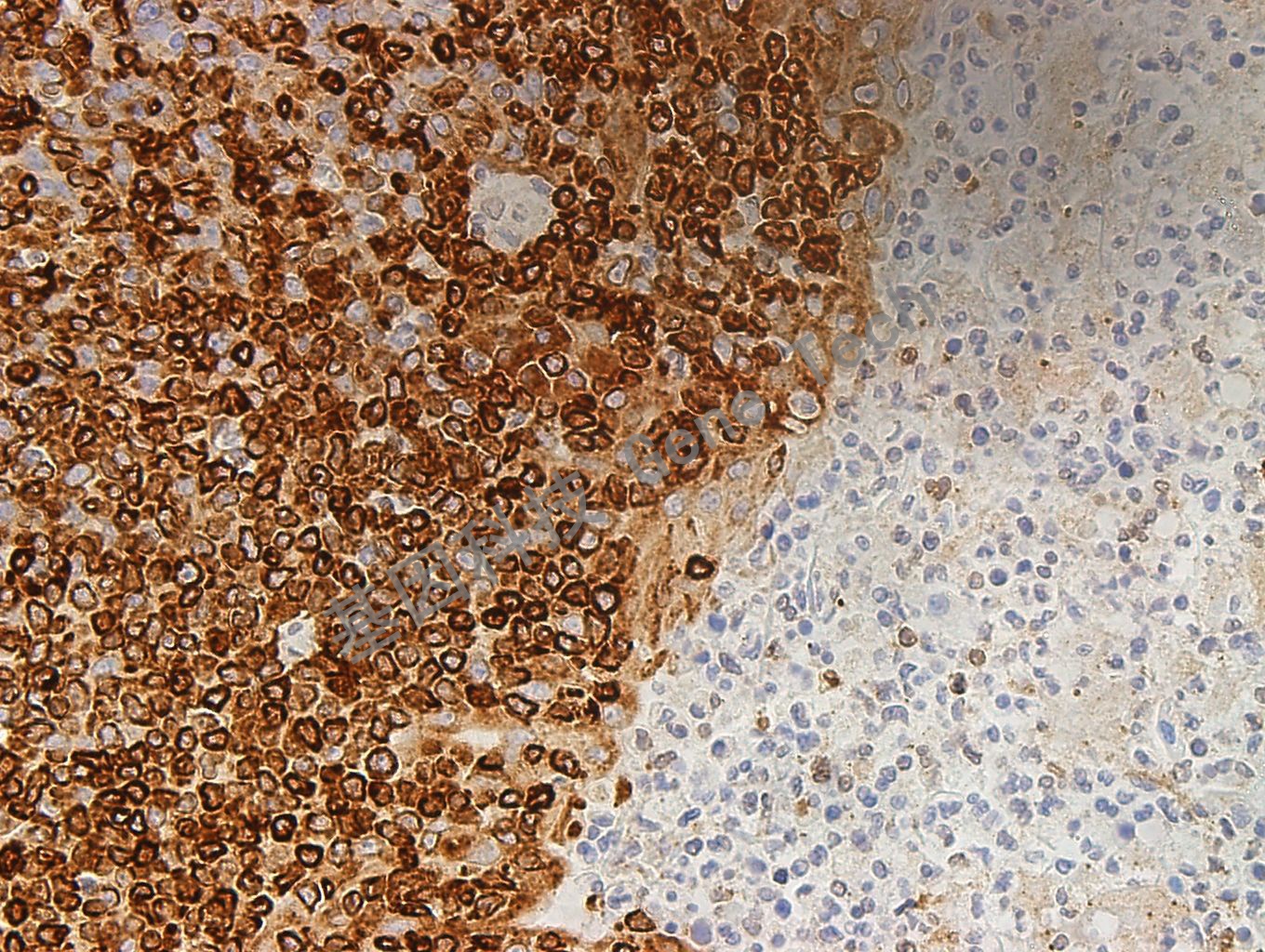 CD74 抗体试剂 鼠抗人 CD74