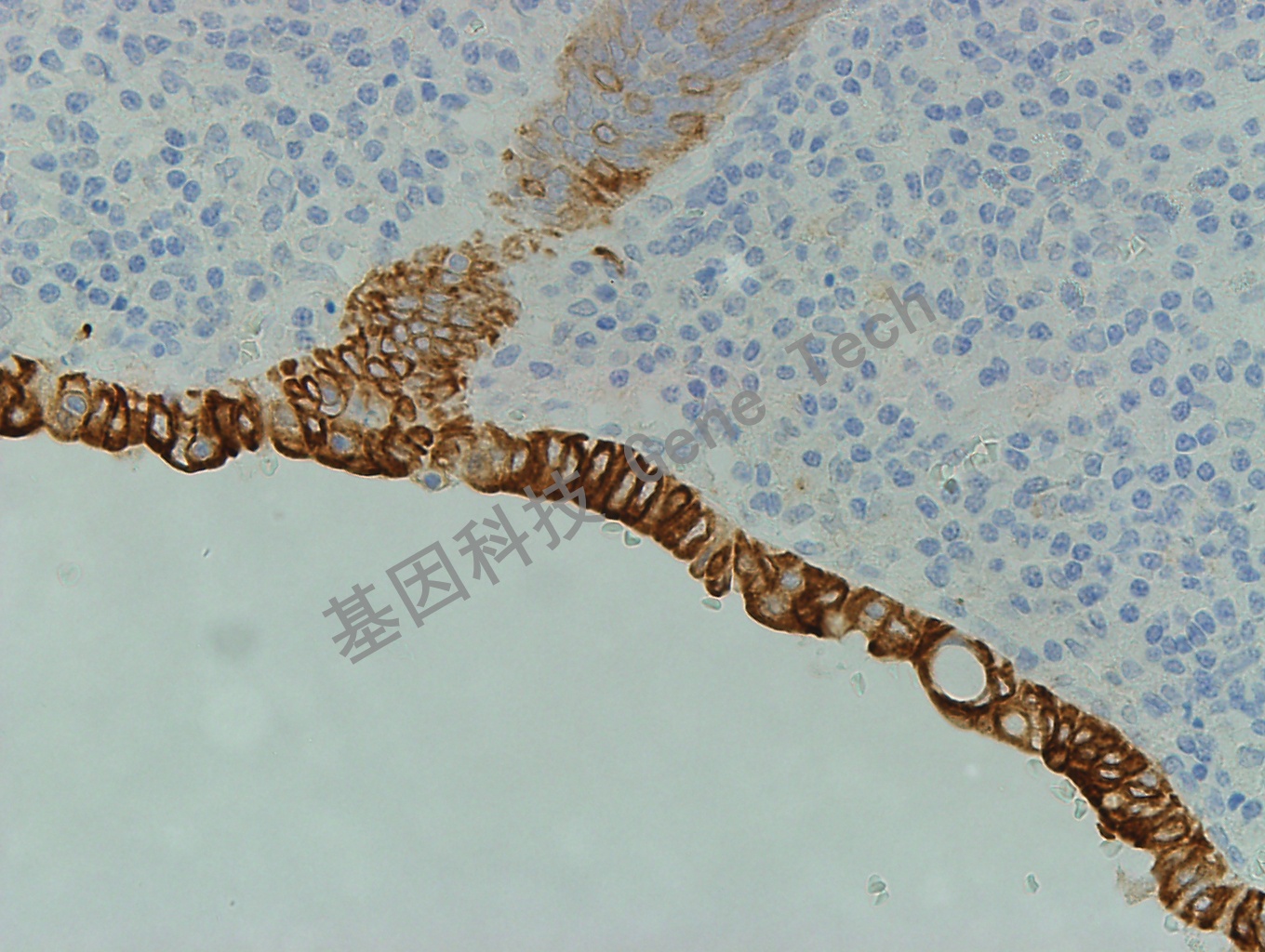 细胞角蛋白 19 抗体 鼠抗人 CK19