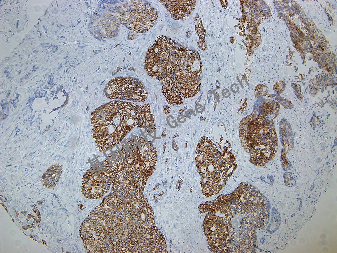 AMACR(p504s) 兔抗人 AMACR/p504s 抗体试剂（免疫组织化学）