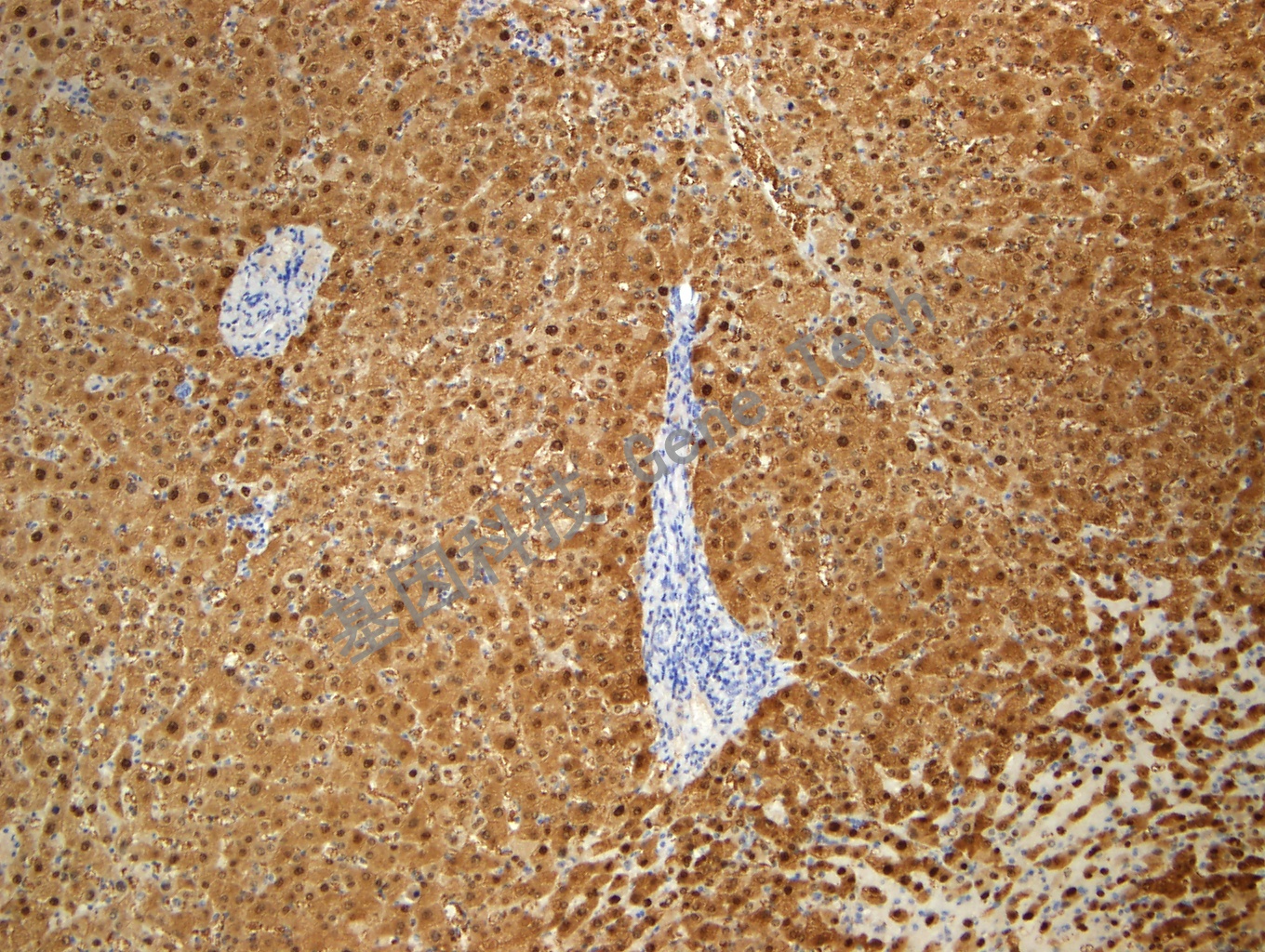 Arginase-1 兔抗人 精氨酸酶1（Arginase-1）抗体试剂（免疫组织化学法）