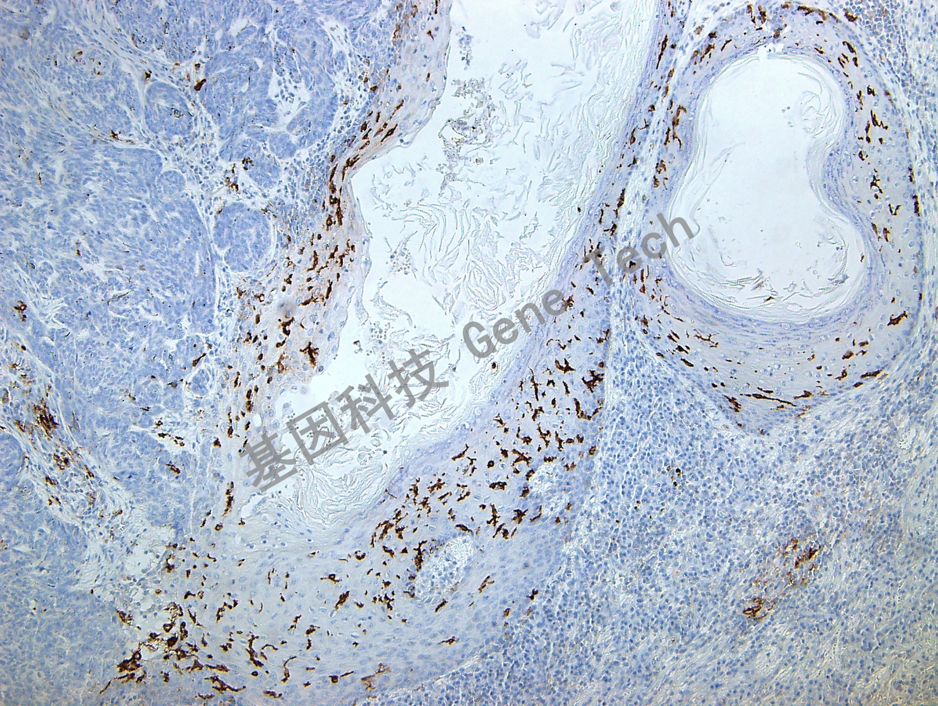 CD1a 抗体 鼠抗人 CD1a