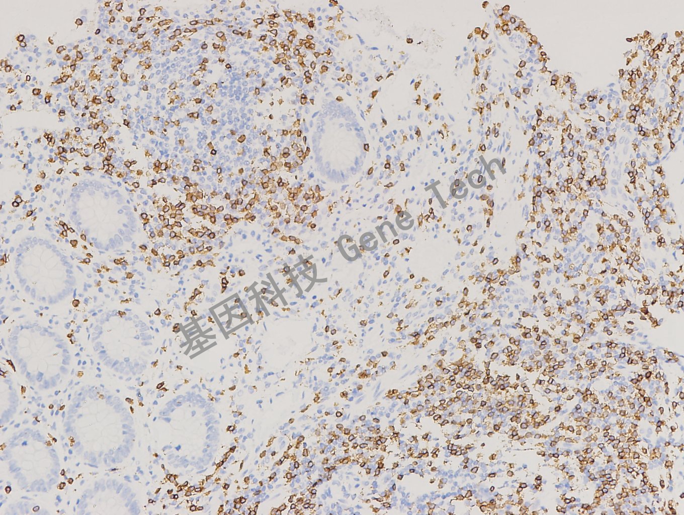 CD3 抗体 兔抗人 CD3