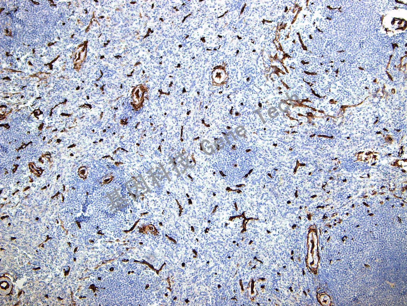 CD34 抗体 鼠抗人 CD34