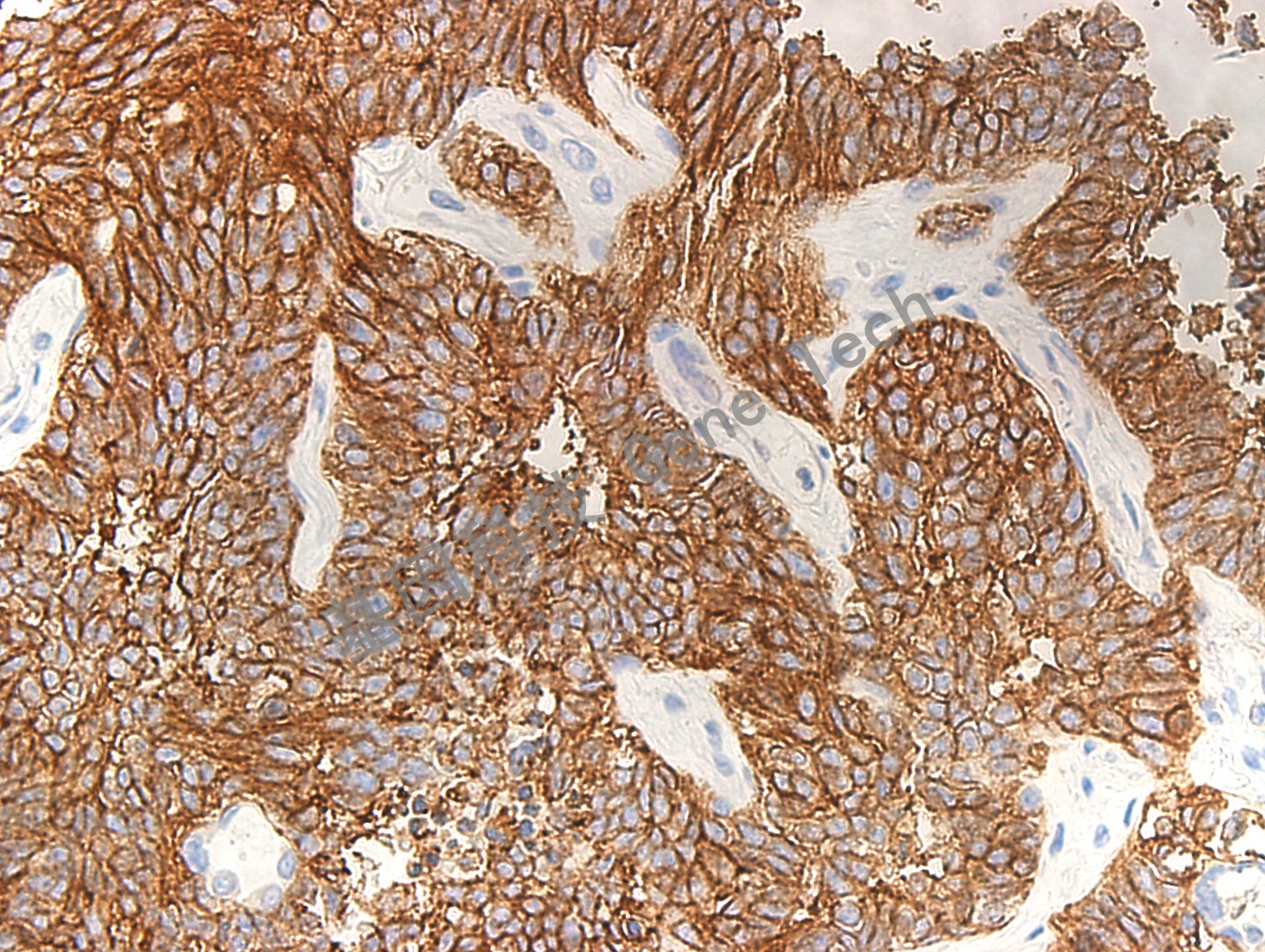 CD56 抗体 鼠抗人 CD56