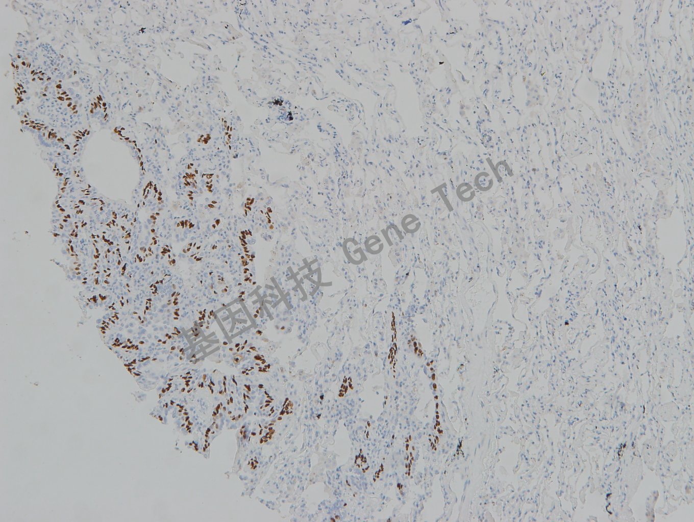 p63 兔抗人 p63 抗体试剂（免疫组织化学）