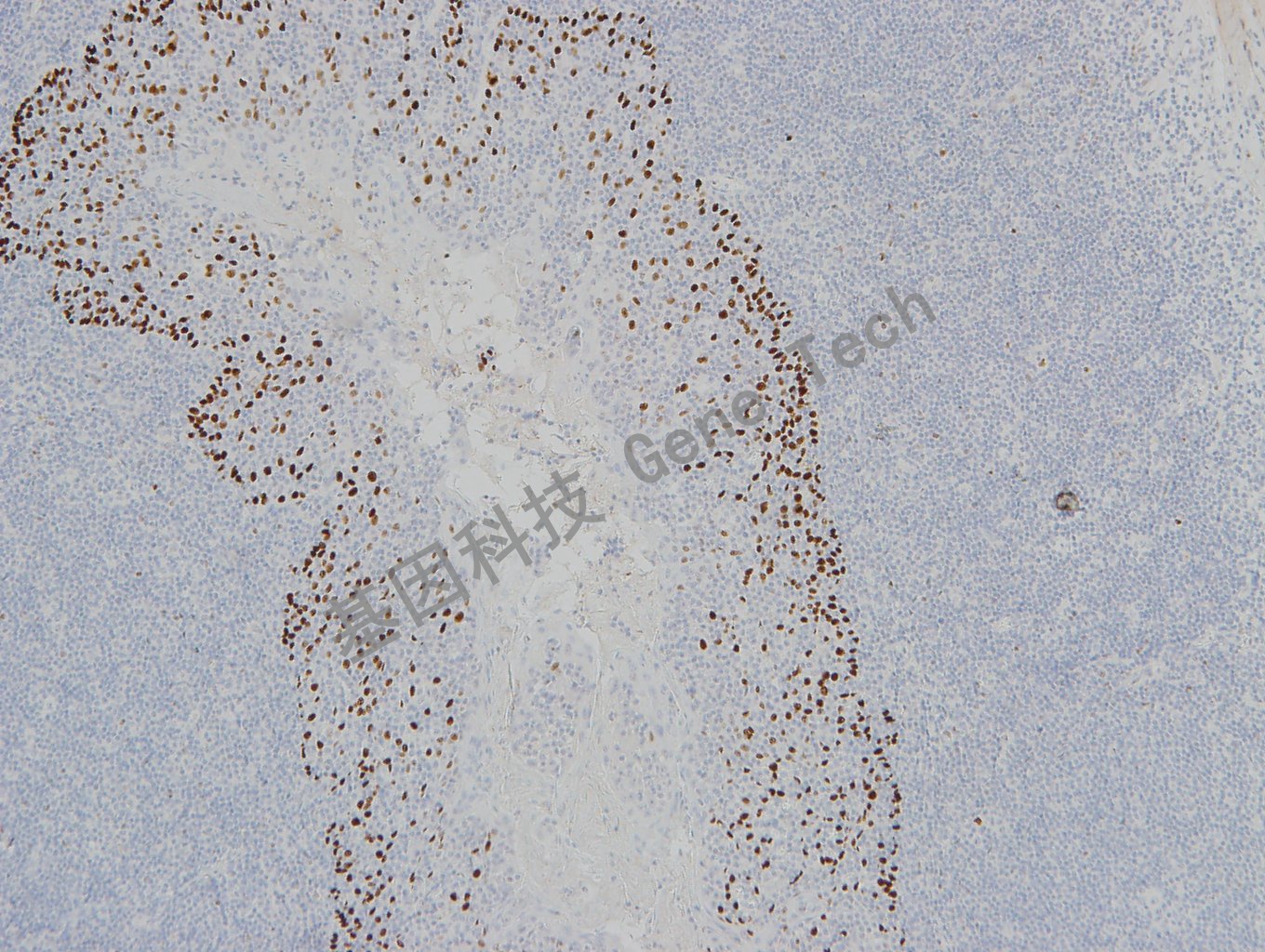 p63 兔抗人 p63 抗体试剂（免疫组织化学）