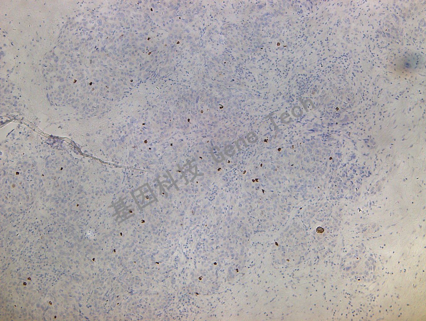 PHH3 兔抗人 磷酸化组蛋白H3（PHH3）抗体试剂（免疫组织化学法）