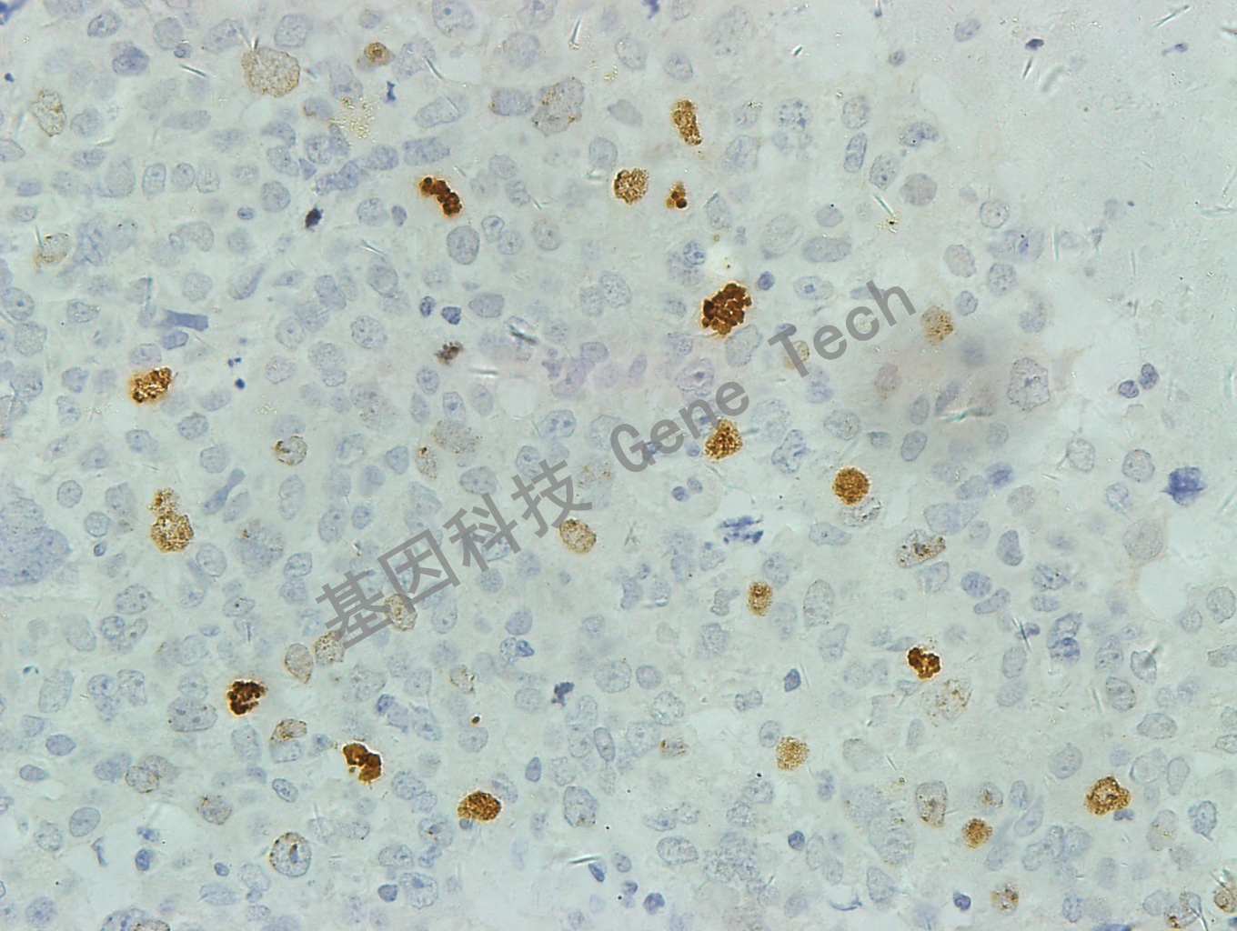 PHH3 兔抗人 磷酸化组蛋白H3（PHH3）抗体试剂（免疫组织化学法）