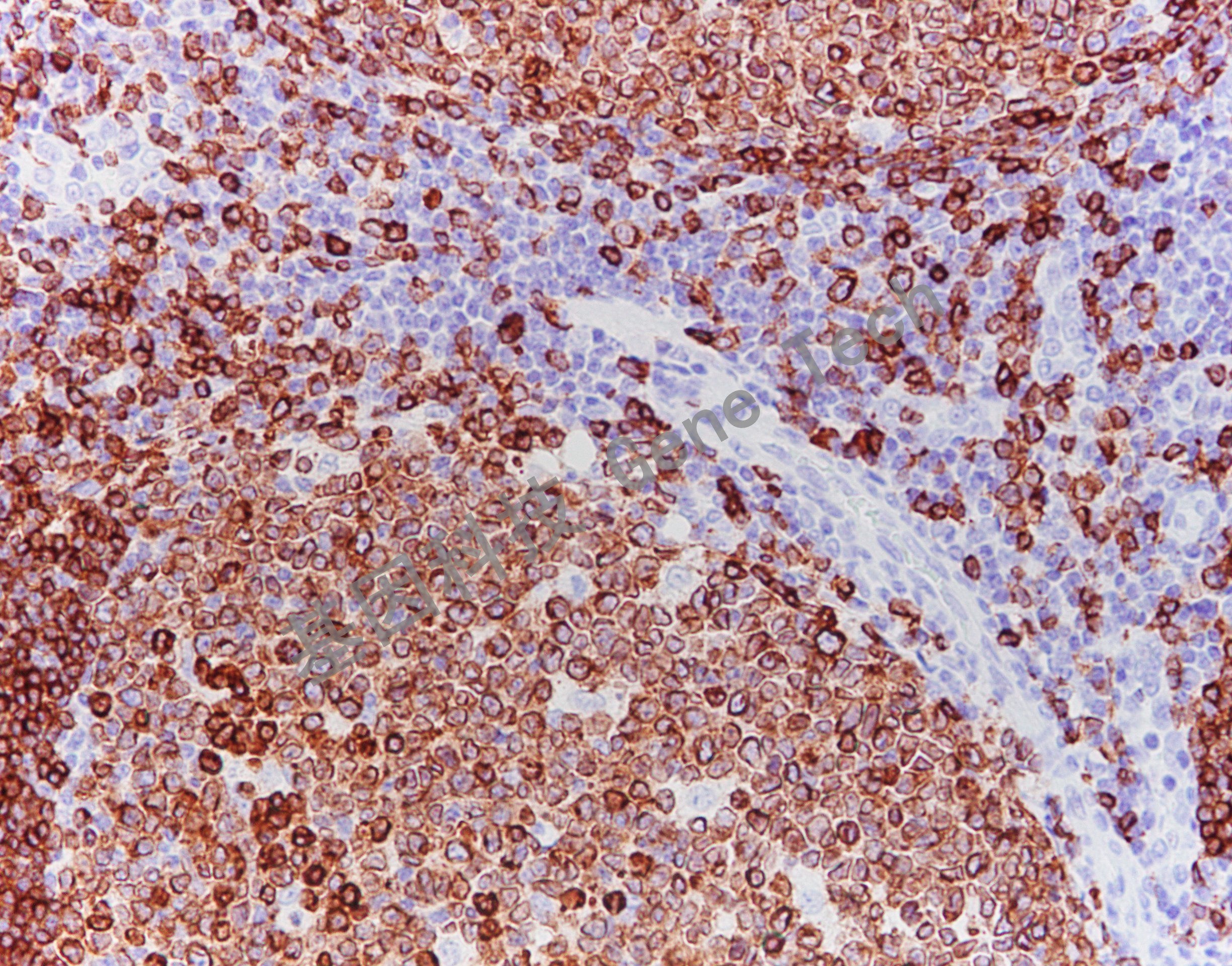 CD79a 抗体 鼠抗人 CD79a