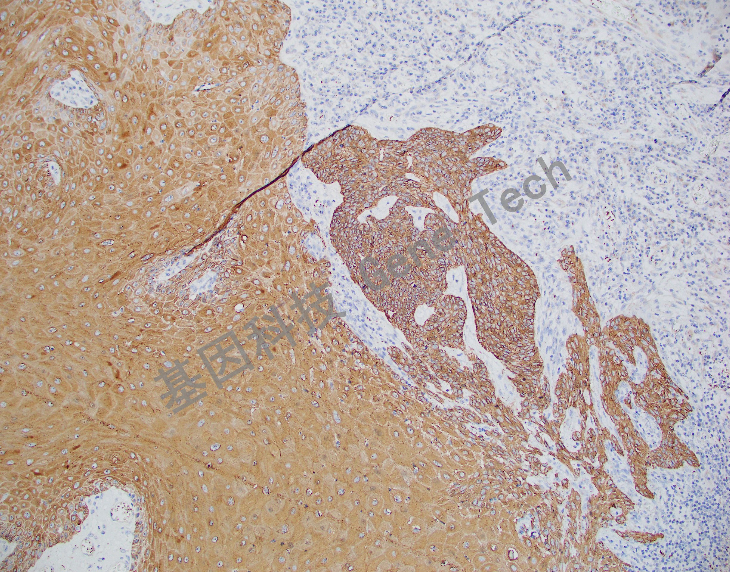 细胞角蛋白 17 抗体 兔抗人 CK17