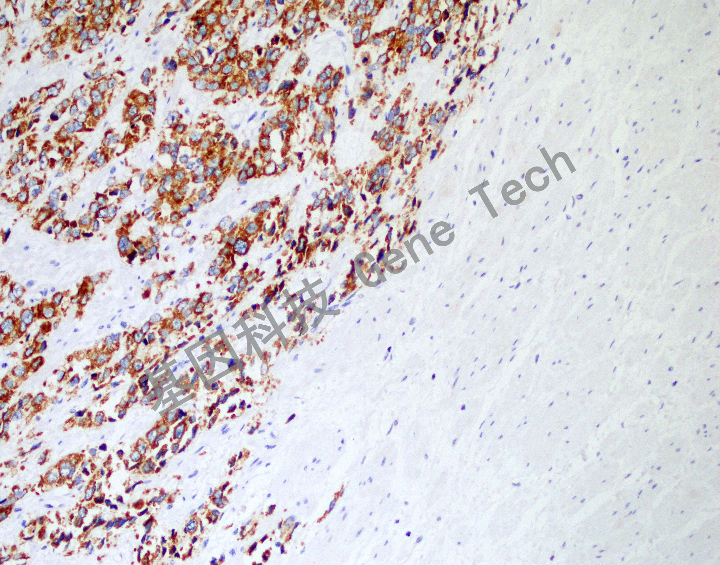 AMACR(p504s) 鼠抗人 AMACR/p504s 抗体试剂（免疫组织化学）