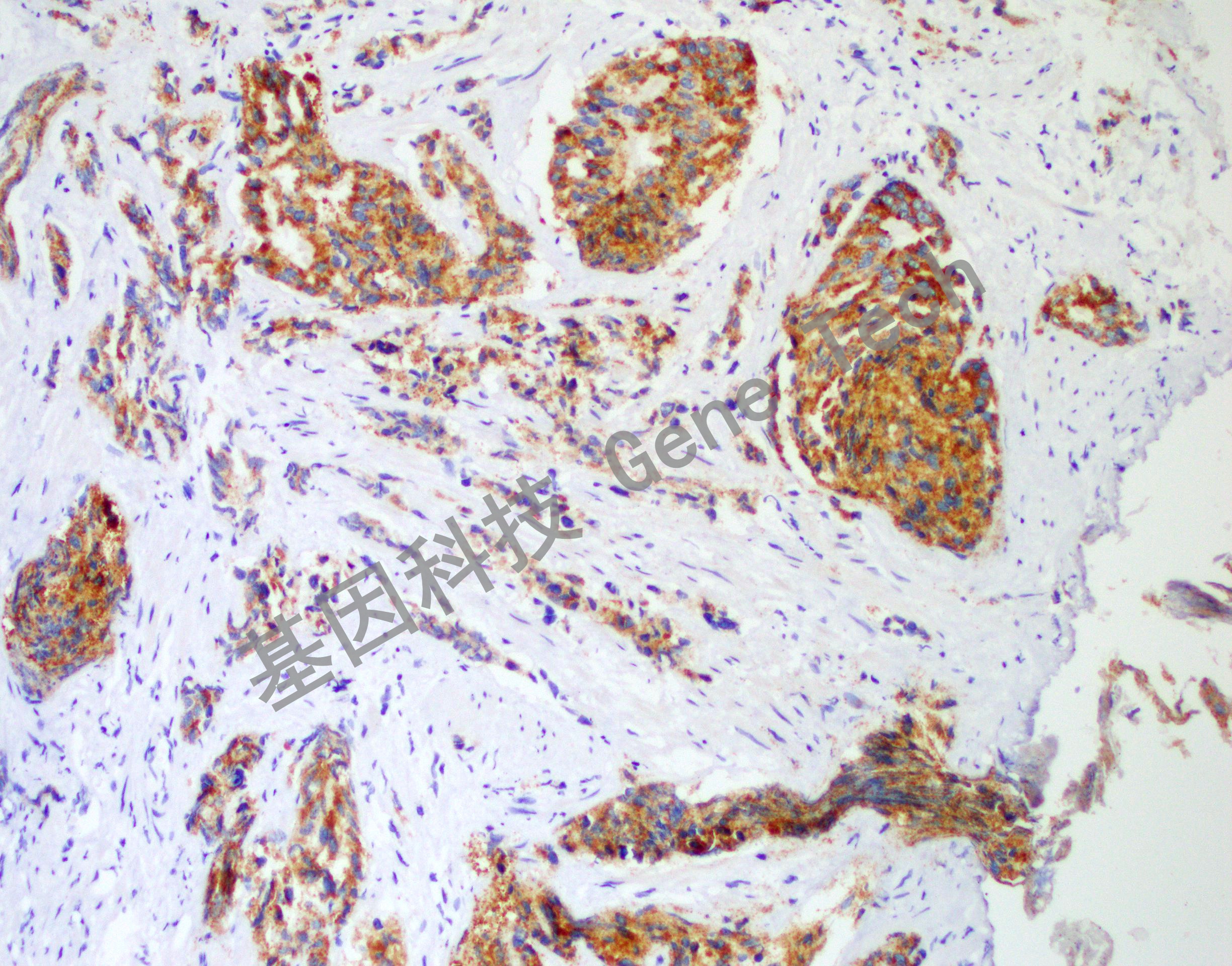 AMACR(p504s) 鼠抗人 AMACR/p504s 抗体试剂（免疫组织化学）