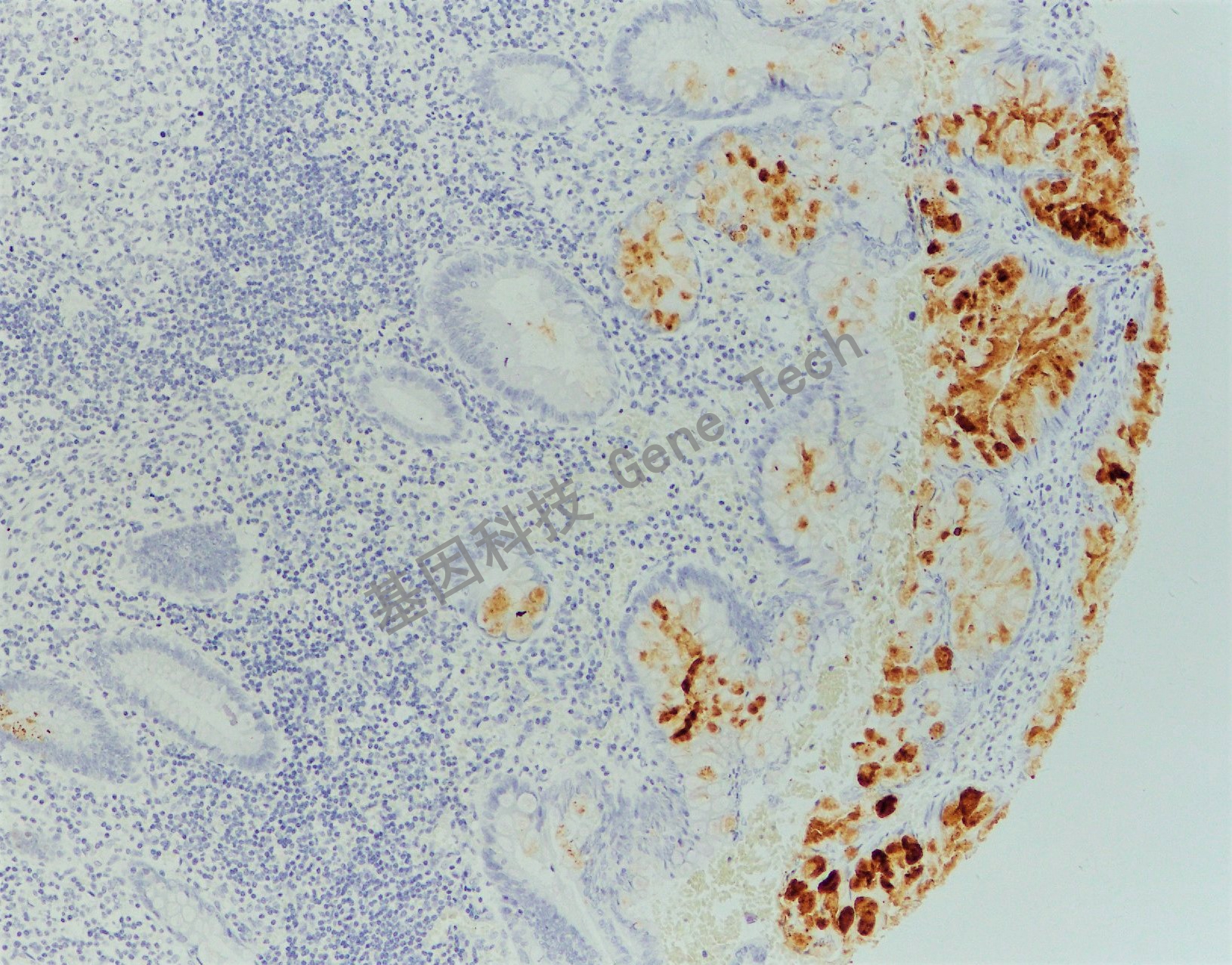 B72.3 鼠抗人 TAG-72 抗体试剂（免疫组织化学）