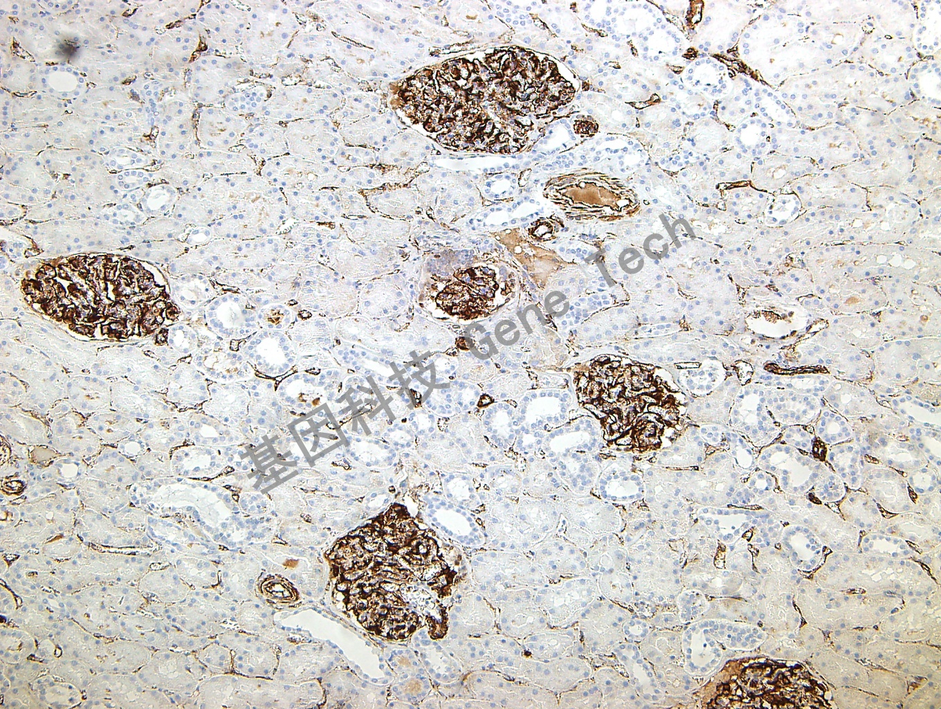 WT1 鼠抗人 WT1抗体试剂（免疫组织化学）
