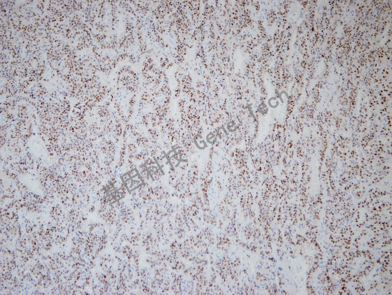 T-Pit 鼠抗人 T-PIT 抗体试剂（免疫组织化学法）