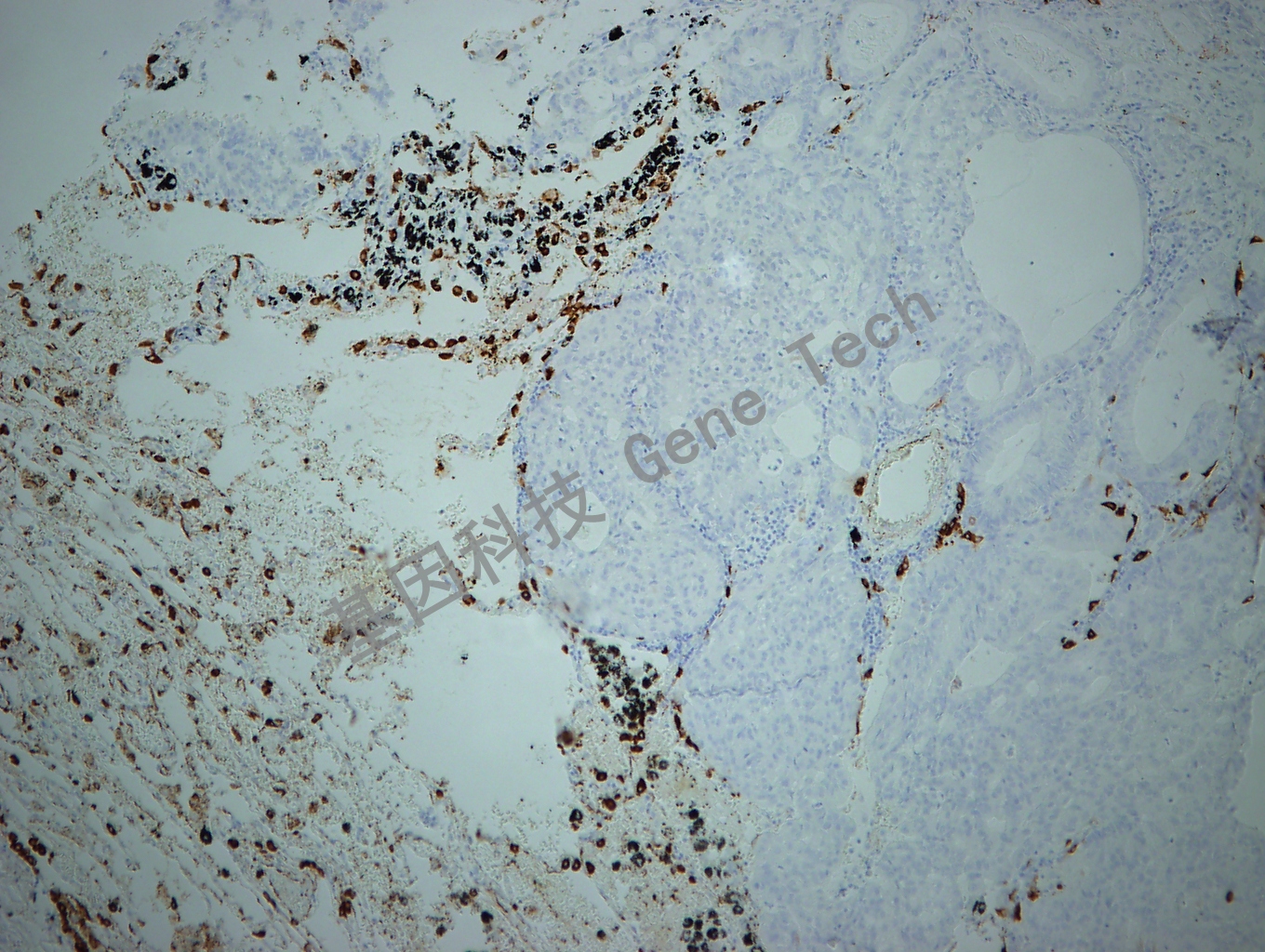 SP-A 鼠抗人 肺表面活性蛋白A（Surfactant Protein A）抗体试剂（免疫组织化学法）