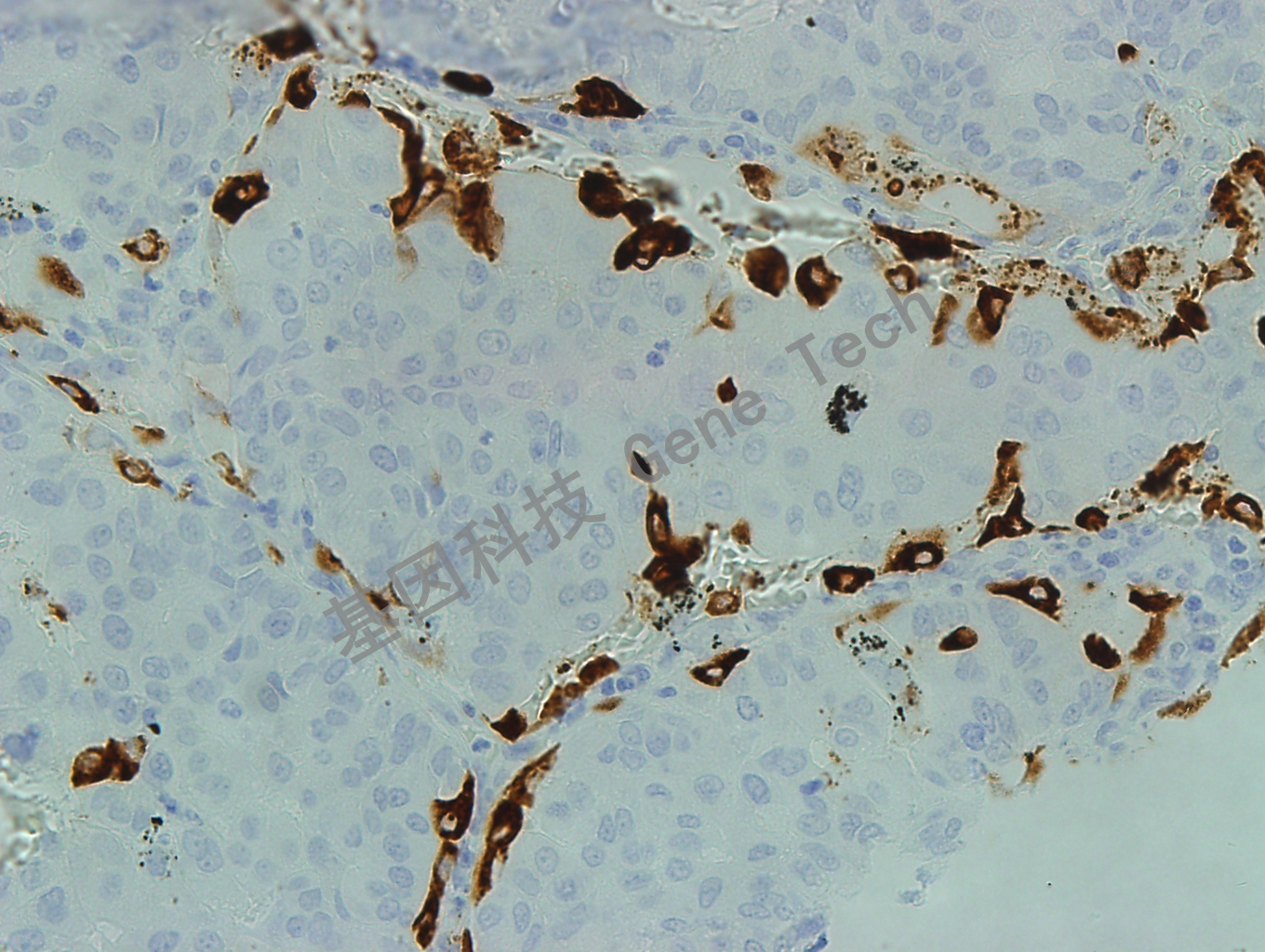 SP-A 鼠抗人 肺表面活性蛋白A（Surfactant Protein A）抗体试剂（免疫组织化学法）