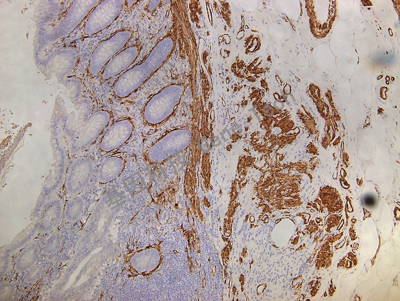 SMA 鼠抗人 SMA 抗体试剂（免疫组织化学）