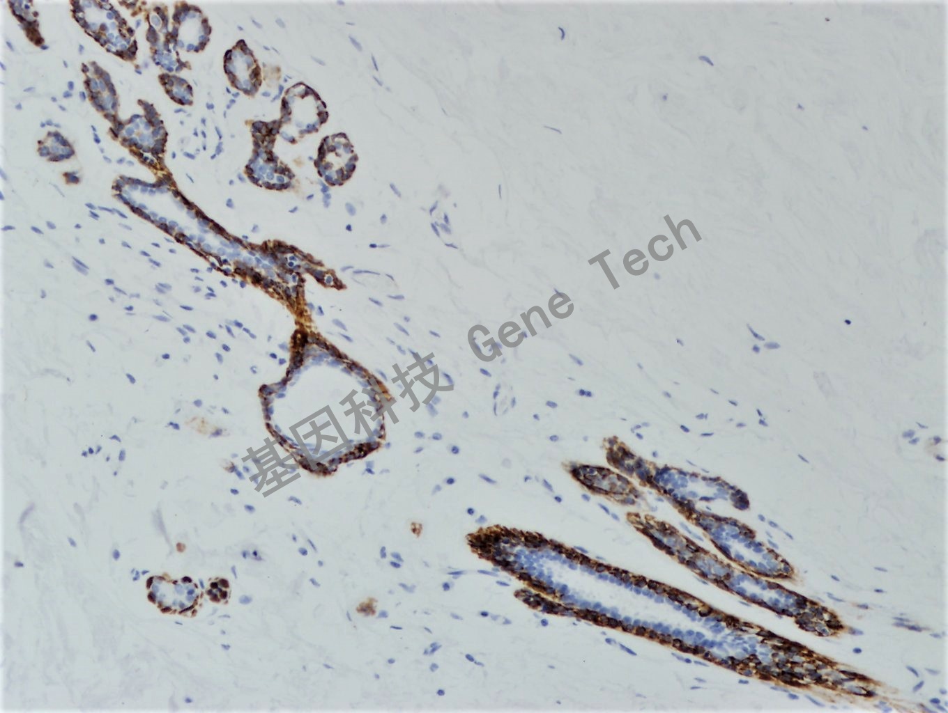 Smooth Muscle Myosin 鼠抗人 Smooth Muscle Myosin 抗体试剂（免疫组织化学）