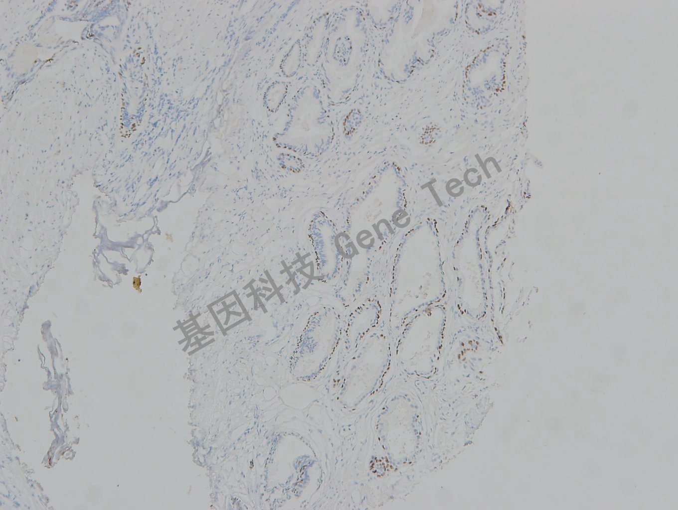 p63 鼠抗人 p63 抗体试剂（免疫组织化学）