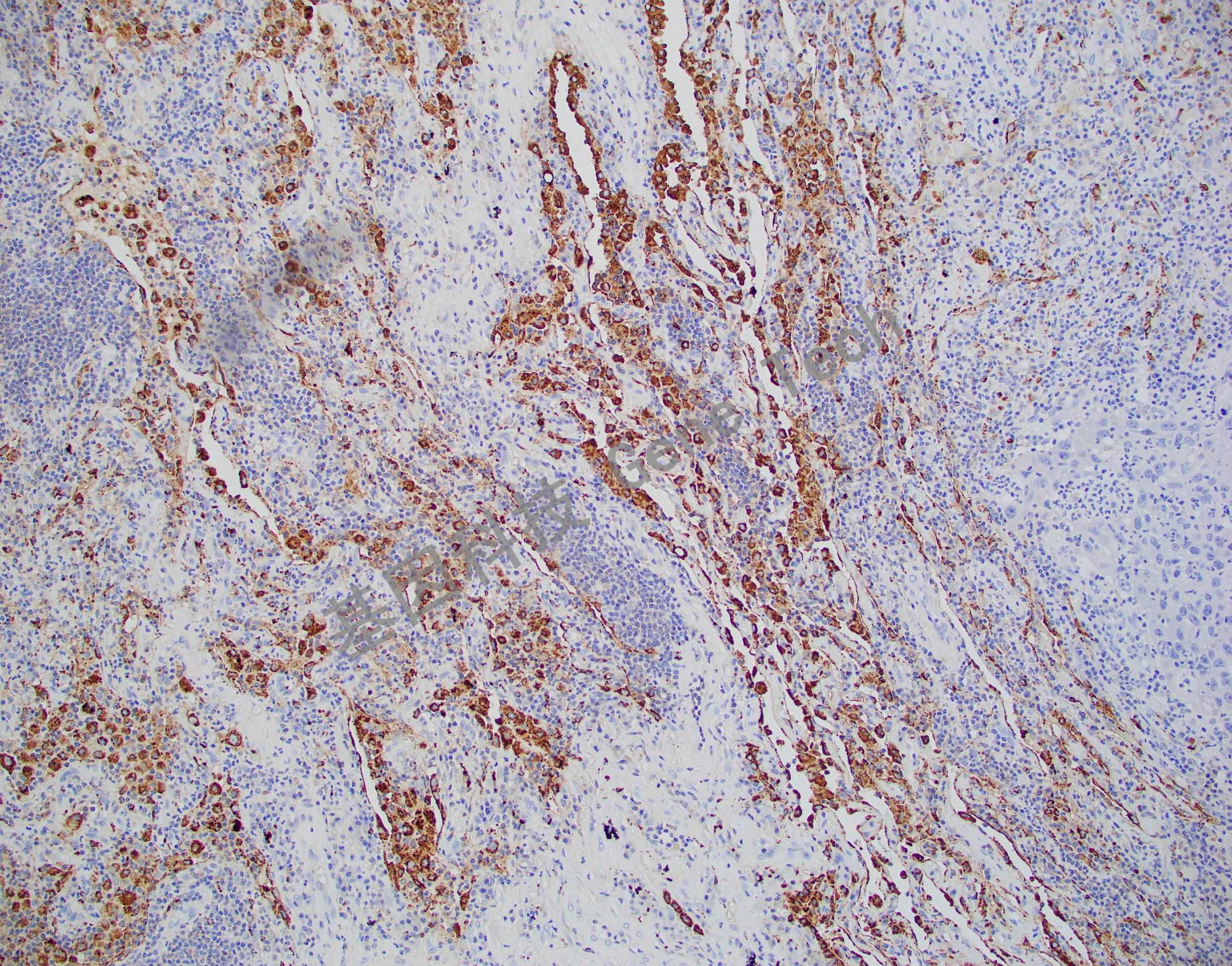 Napsin A 鼠抗人 Napsin A 抗体试剂（免疫组织化学）