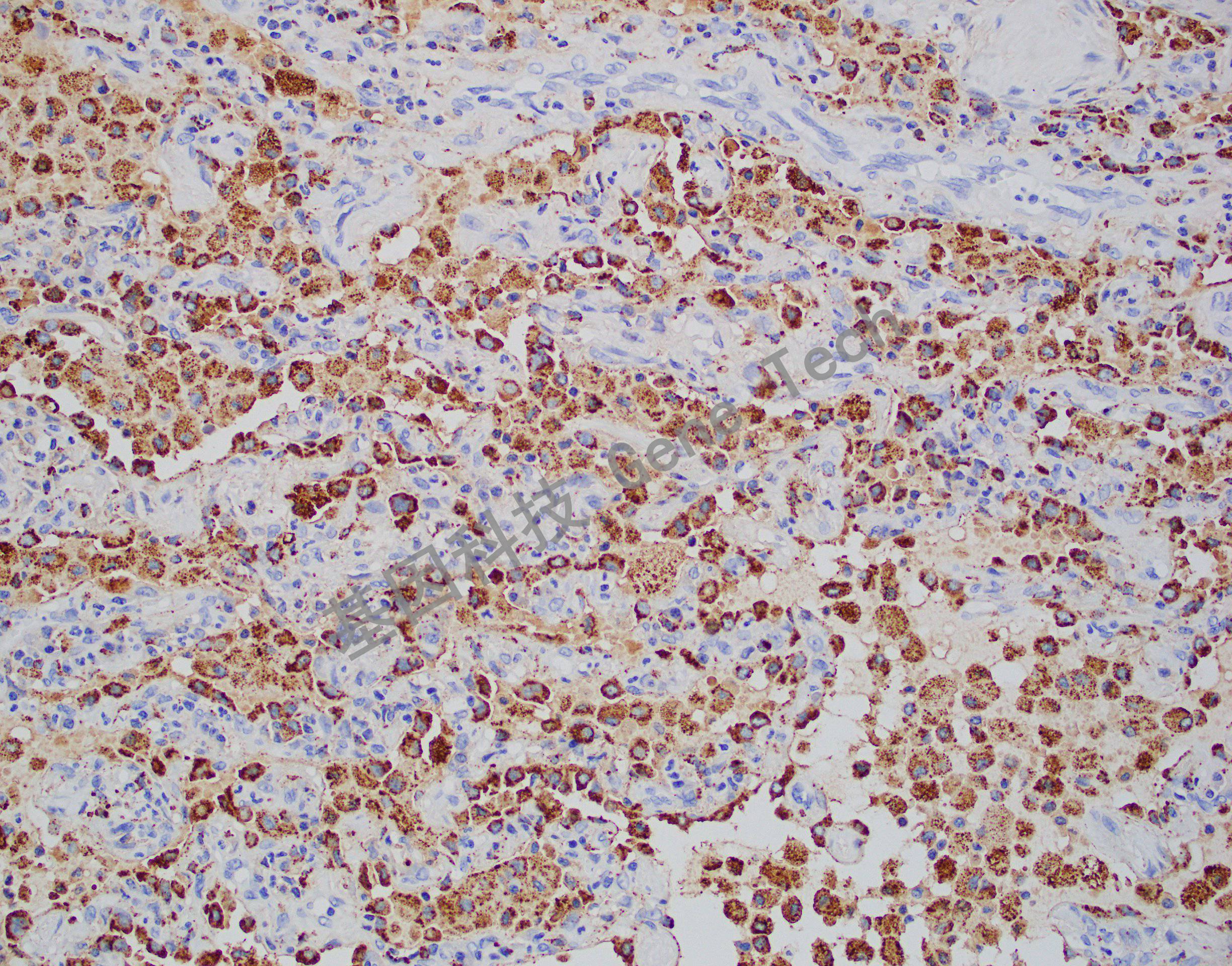 Napsin A 鼠抗人 Napsin A 抗体试剂（免疫组织化学）