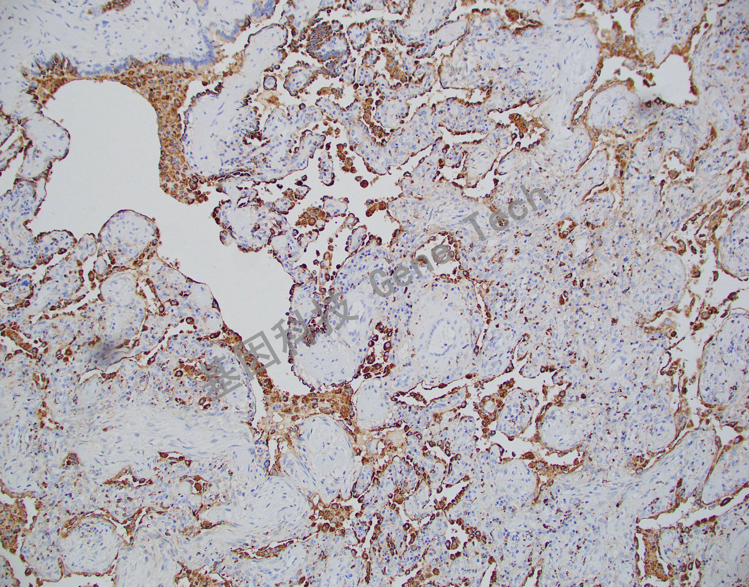 Napsin A 鼠抗人 Napsin A 抗体试剂（免疫组织化学）