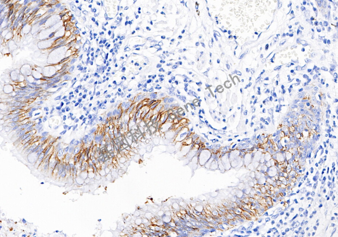 Ep-CAM 鼠抗人 Ep-CAM 抗体试剂（免疫组织化学）（Ber-EP4）