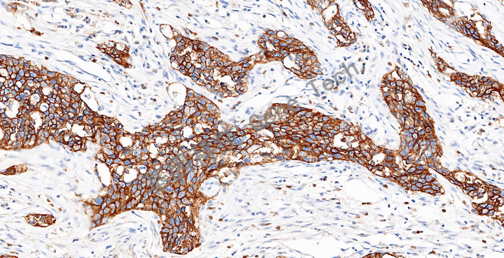 CD44v6 鼠抗人 CD44v6 抗体试剂（免疫组织化学法）