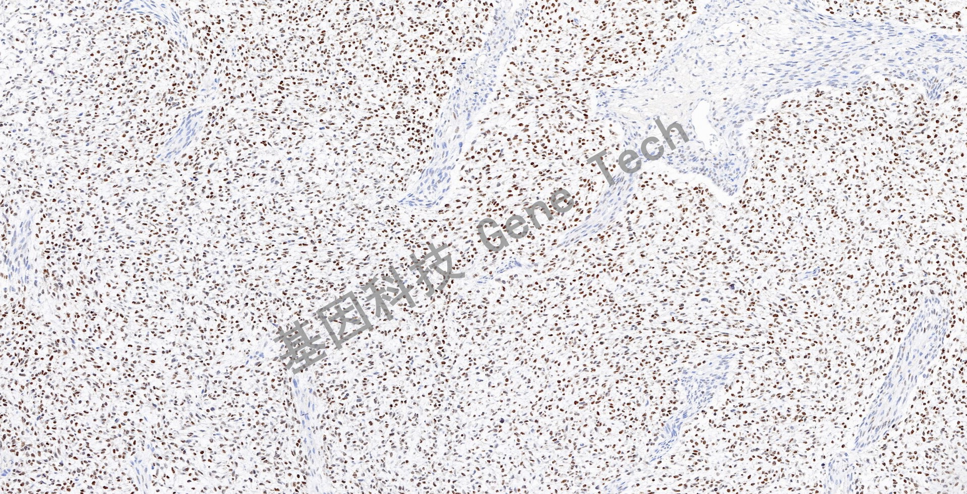 BCOR 鼠抗人 BCOR 抗体试剂（免疫组织化学）