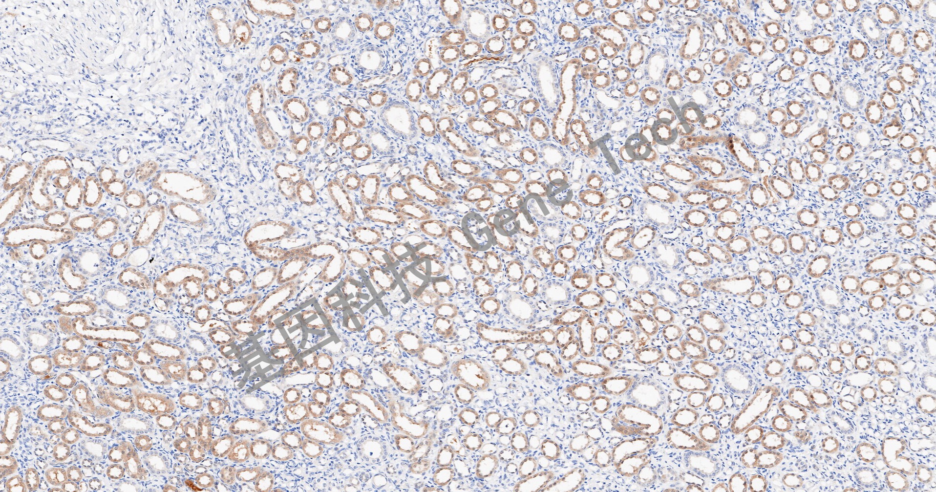 CYP11B2 兔抗人 CYP11B2 抗体试剂（免疫组织化学法）