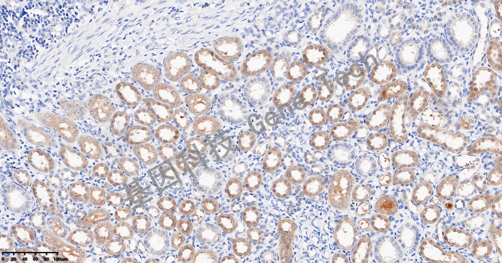 CYP11B2 兔抗人 CYP11B2 抗体试剂（免疫组织化学法）