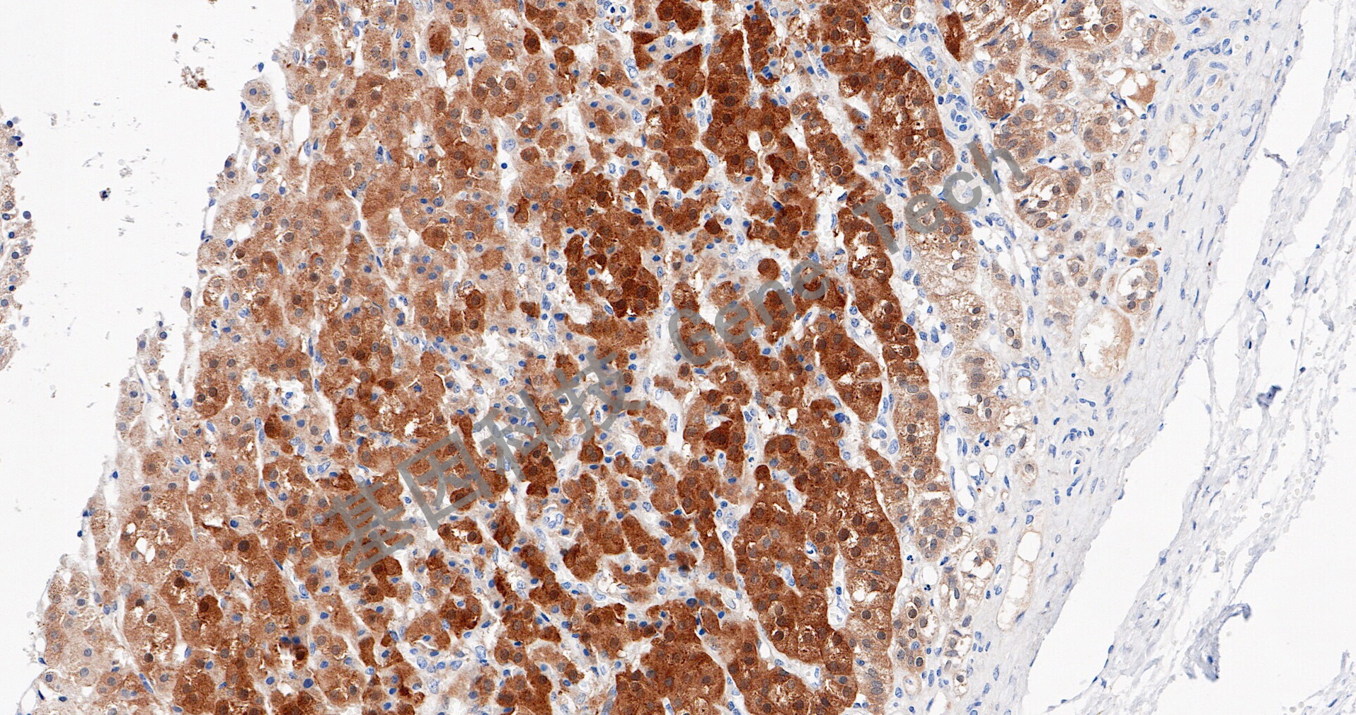 CYP11B2 兔抗人 CYP11B2 抗体试剂（免疫组织化学法）