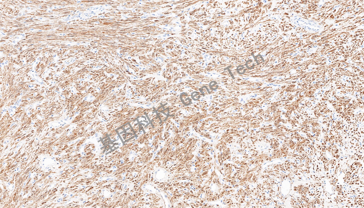 2SC 兔抗人 2SC 抗体试剂（免疫组织化学法）