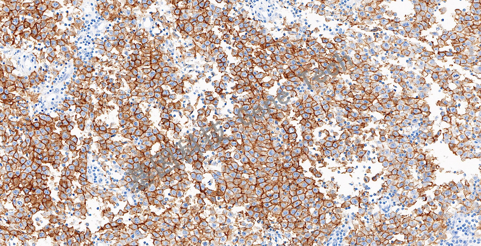 CD117（c-kit）兔抗人 CD117（c-kit）