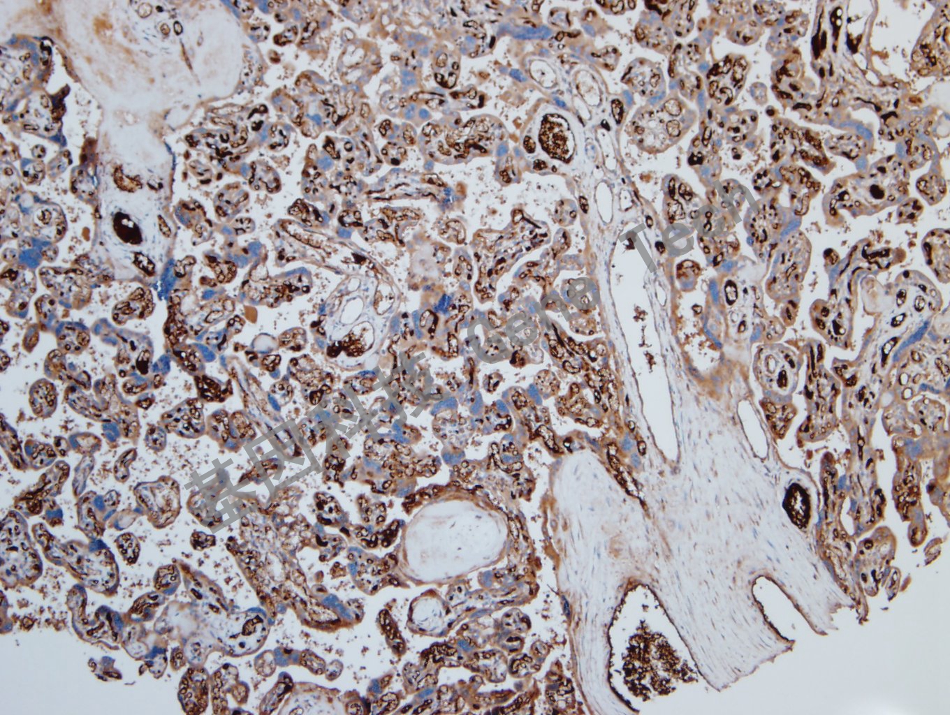AFP 兔抗人 Alpha-1-Fetoprotein 抗体试剂（免疫组织化学）